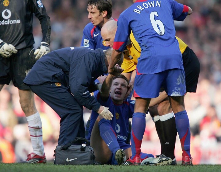 broken bones in soccer