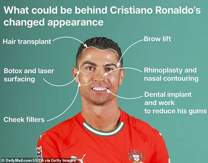 ronaldo teeth surgery
